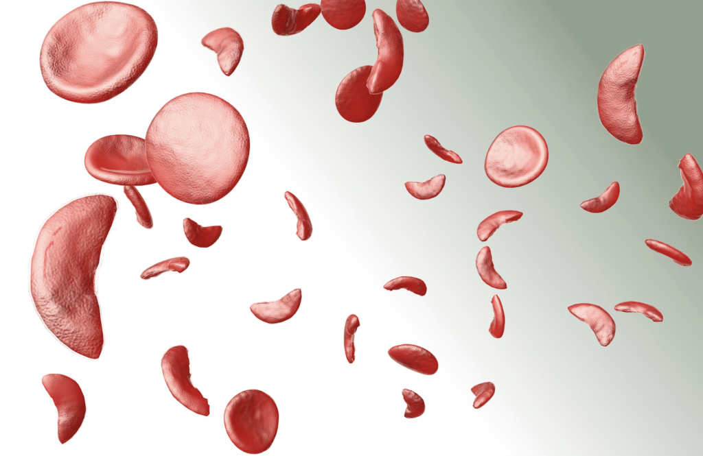 Importance de l'électrophorèse de l'hémoglobine dans la prévention de ...